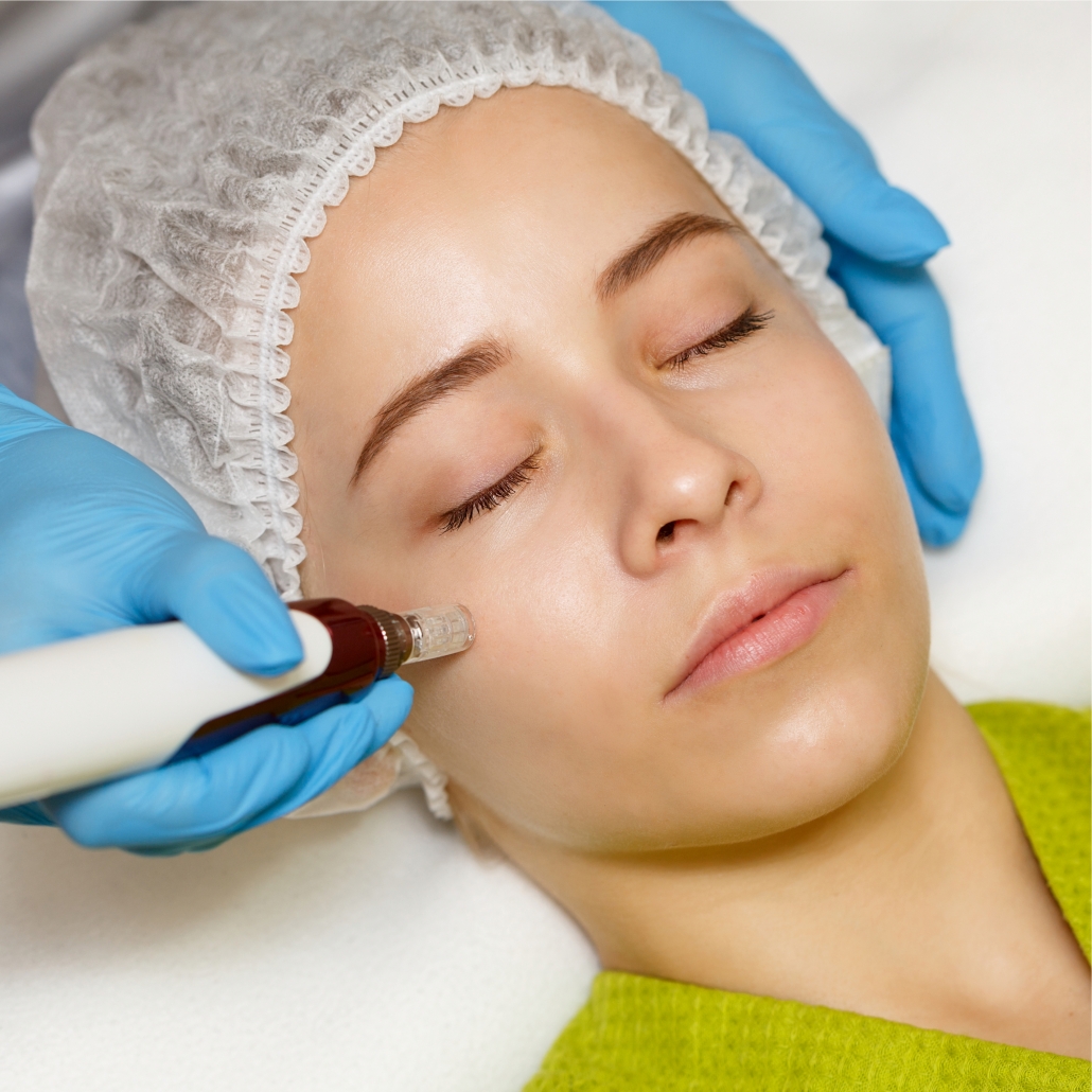 Micro Needling - Chaelis Advanced Aesthetics